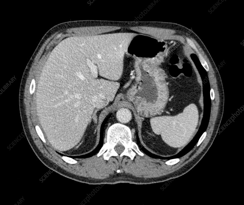 Imaging - London Liver Centre